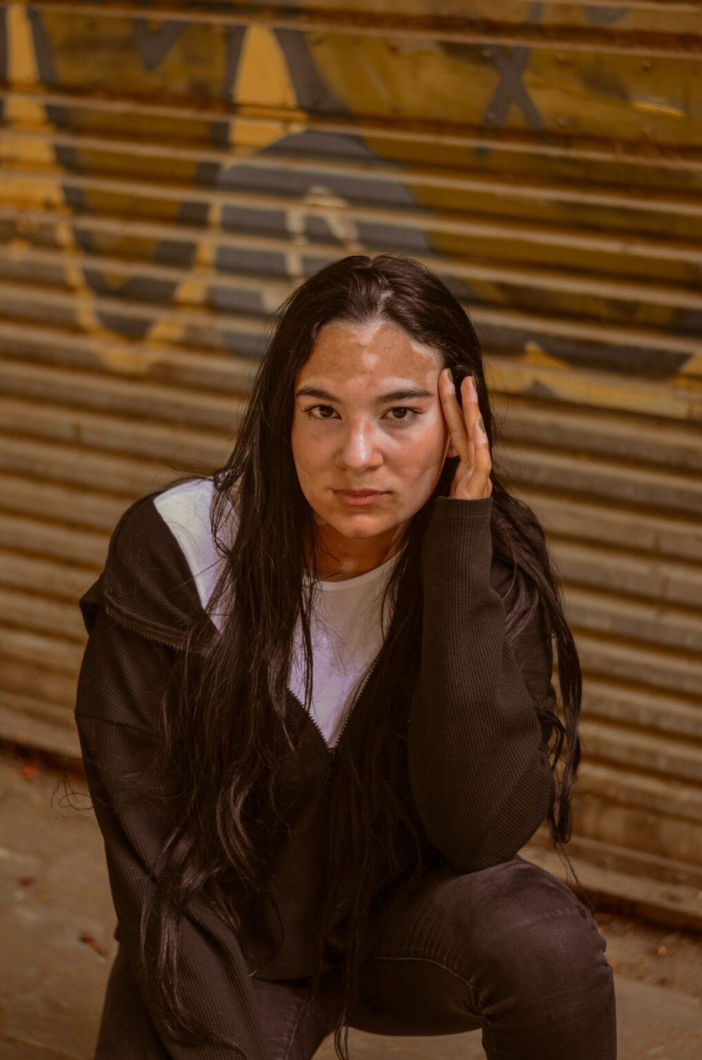 Understanding Hypopigmentation | Treatment & Causes